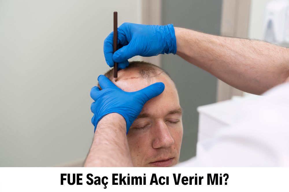Safir Fue Saç Ekimi - Unisa Health Turkey